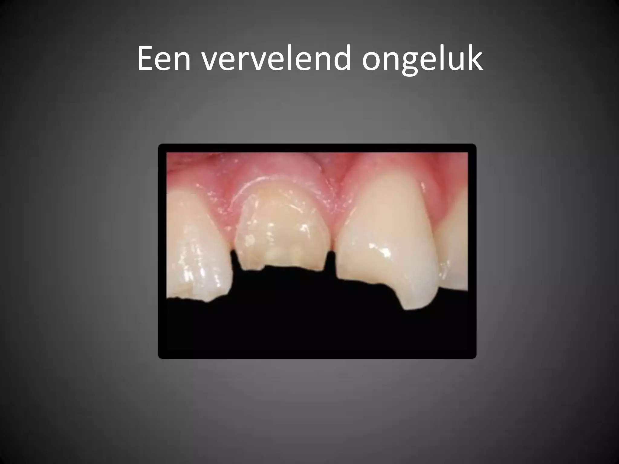 Enkele voorbeelden van esthetische behandelingen uit onze praktijk | PPTX