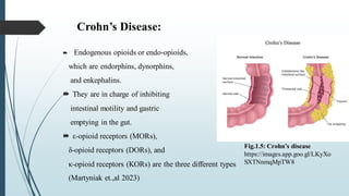 ENKEPHALIN PPT (final).. (2)-1.pdf
