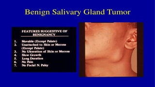 enlarged parotid swelling diagnosis and management.ppt