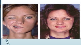 enlarged parotid swelling diagnosis and management.ppt
