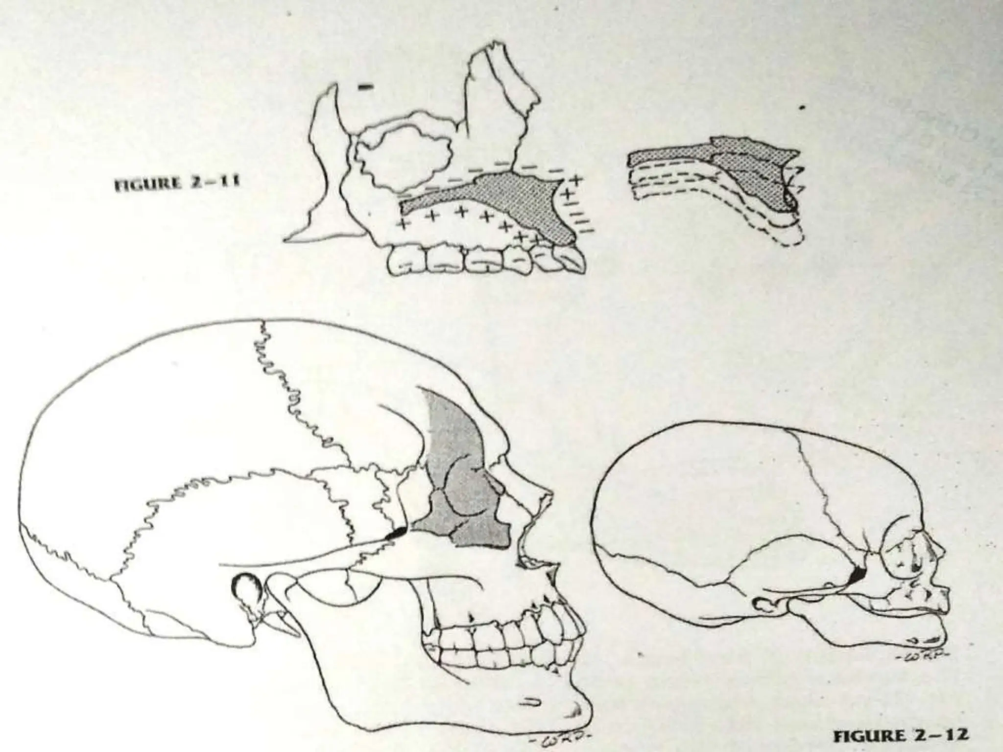 ENLOW’S ‘V’ & COUNTERPART PRINCIPLE by Dr. Sourabh Dutta.pptx