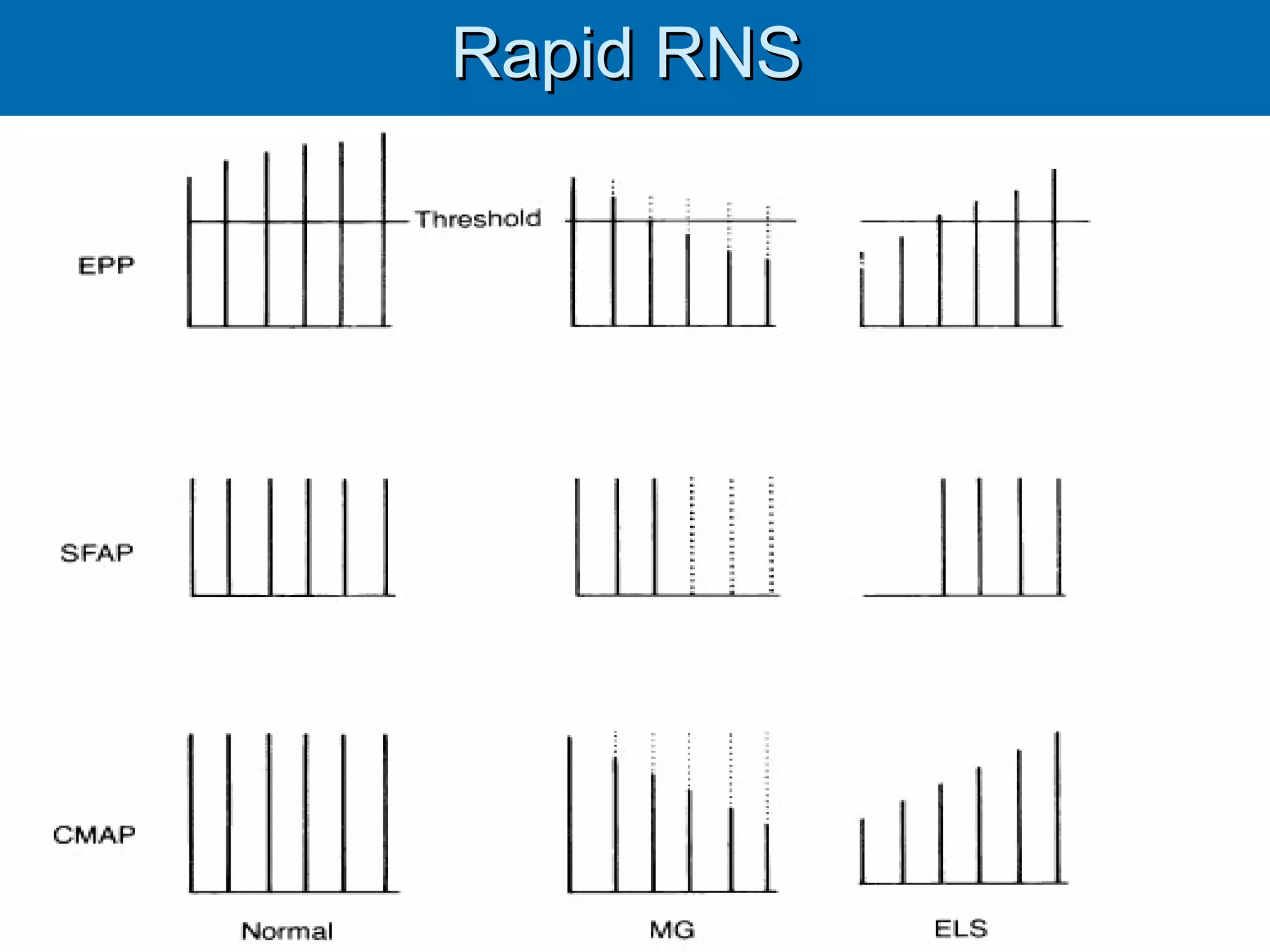repetitive nerve stimulation | PPT