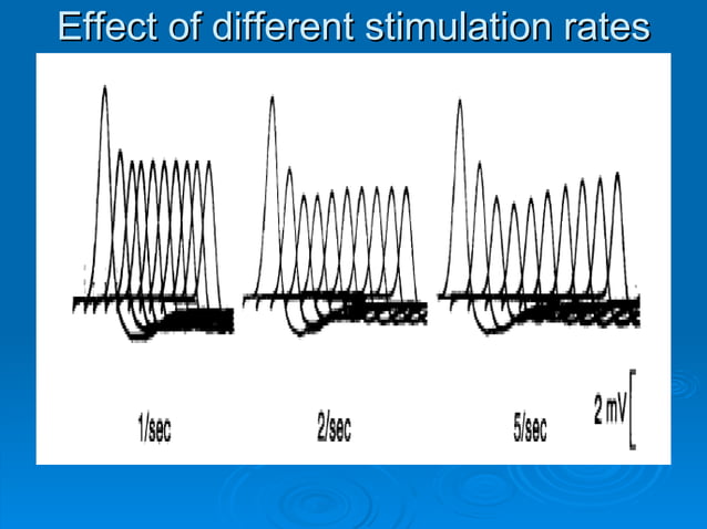 repetitive nerve stimulation