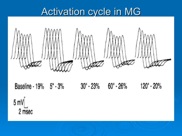 repetitive nerve stimulation | PPT | Physical Therapy | Wellness