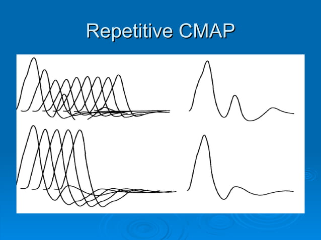 repetitive nerve stimulation | PPT | Physical Therapy | Wellness