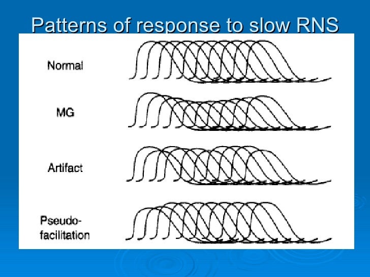 repetitive nerve stimulation