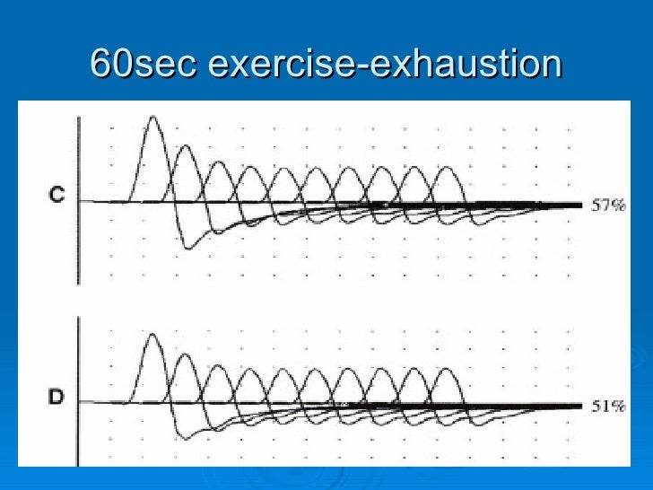 repetitive nerve stimulation