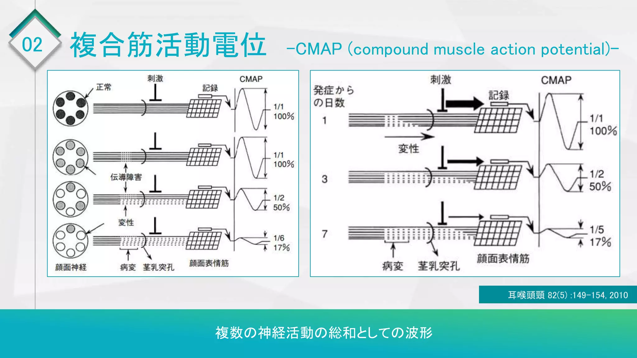 顔面神経麻痺の検査とENoGの基礎 | PPTX