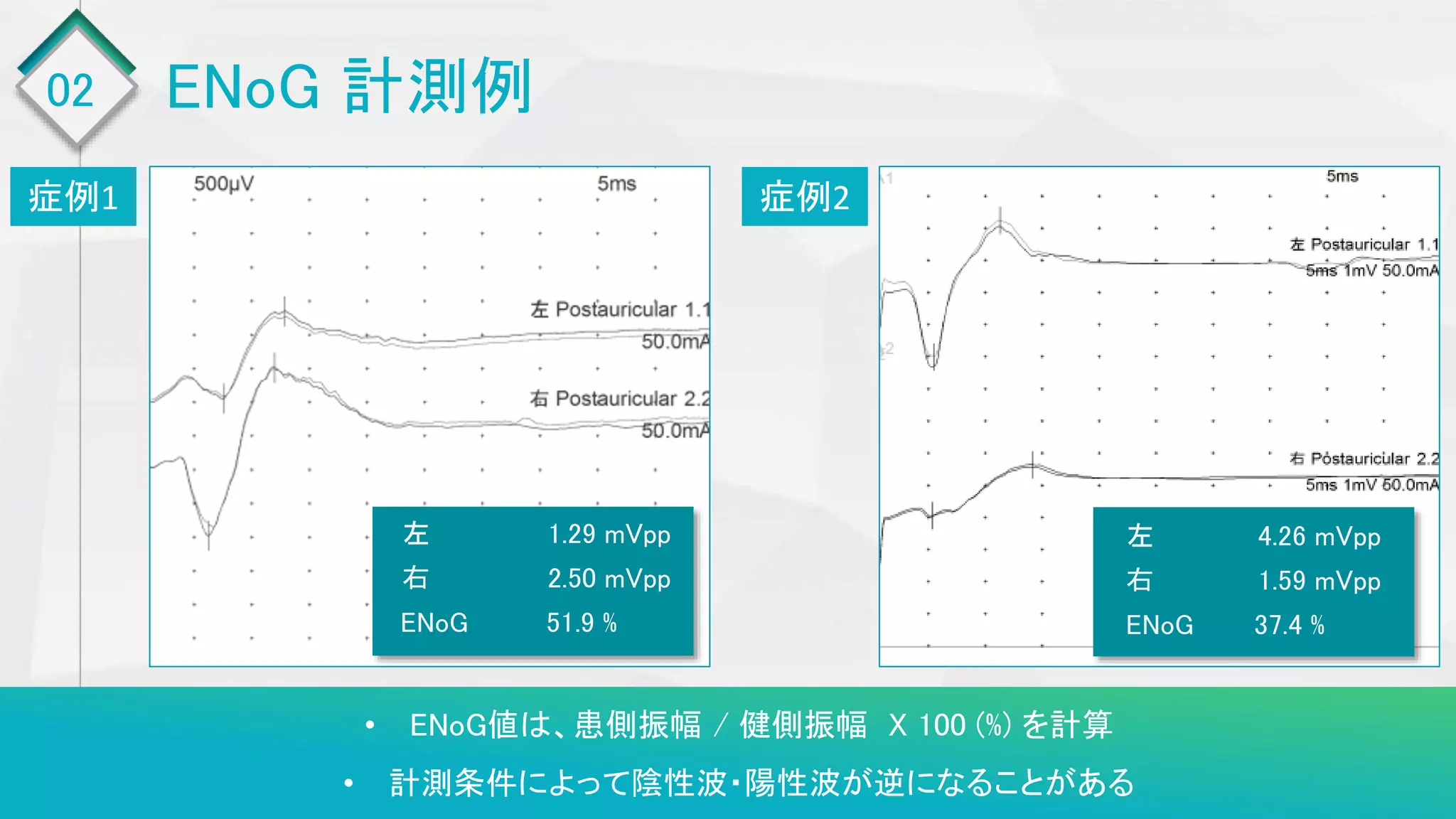 顔面神経麻痺の検査とENoGの基礎 | PPTX