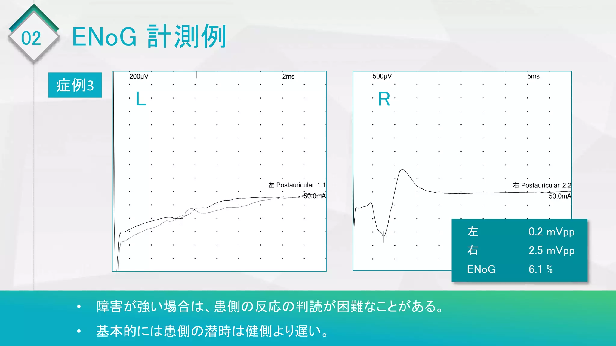 顔面神経麻痺の検査とENoGの基礎 | PPTX