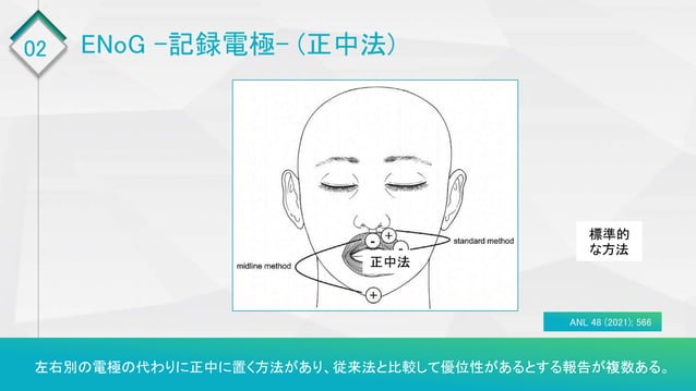 顔面神経麻痺の検査とENoGの基礎 | PPTX | Physical Therapy | Wellness