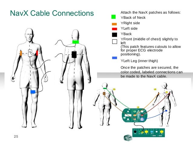 EnSite™ System的基本設定_20120909_中區