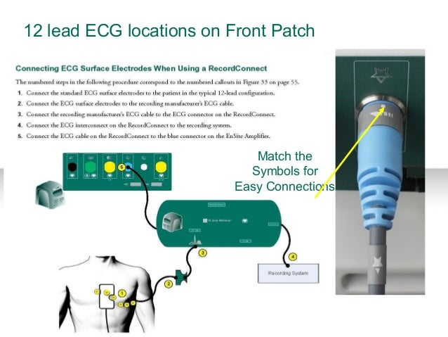 EnSite™ System的基本設定_20120909_中區
