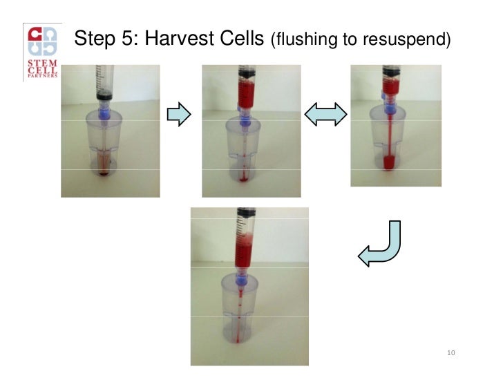 Ensura sep briefing (cell washing concentrate)