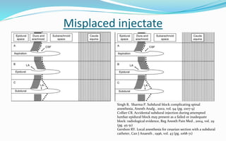 Ensuring success in Spinal Anesthesia.pptx