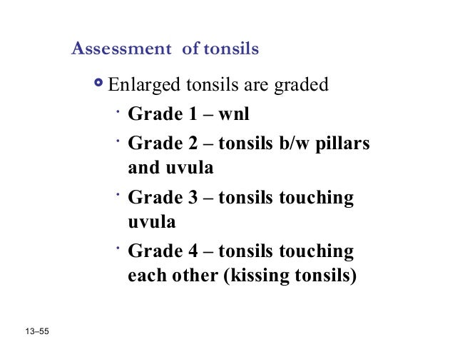 Tonsil Grading Chart