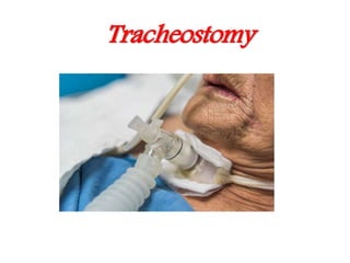 Tracheostomy | PPT