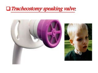 Tracheostomy | PPT