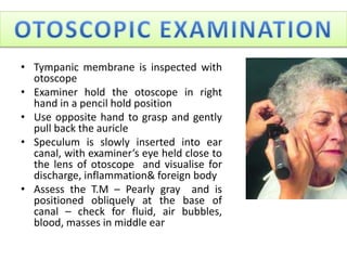 ENT ASSESSMENT | PPTX