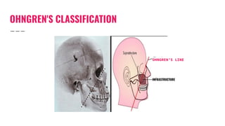 Malignant tumors of Nose and PNS | PDF