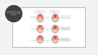 Tuning fork tests - ENT | PPTX