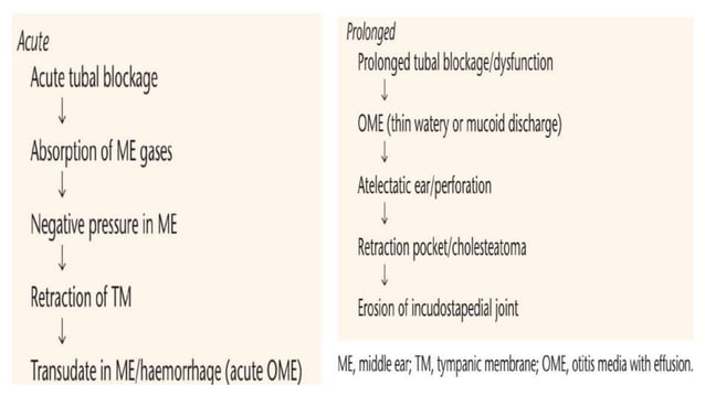 ENT presentation on the disorders of eustachian tube for | PPT