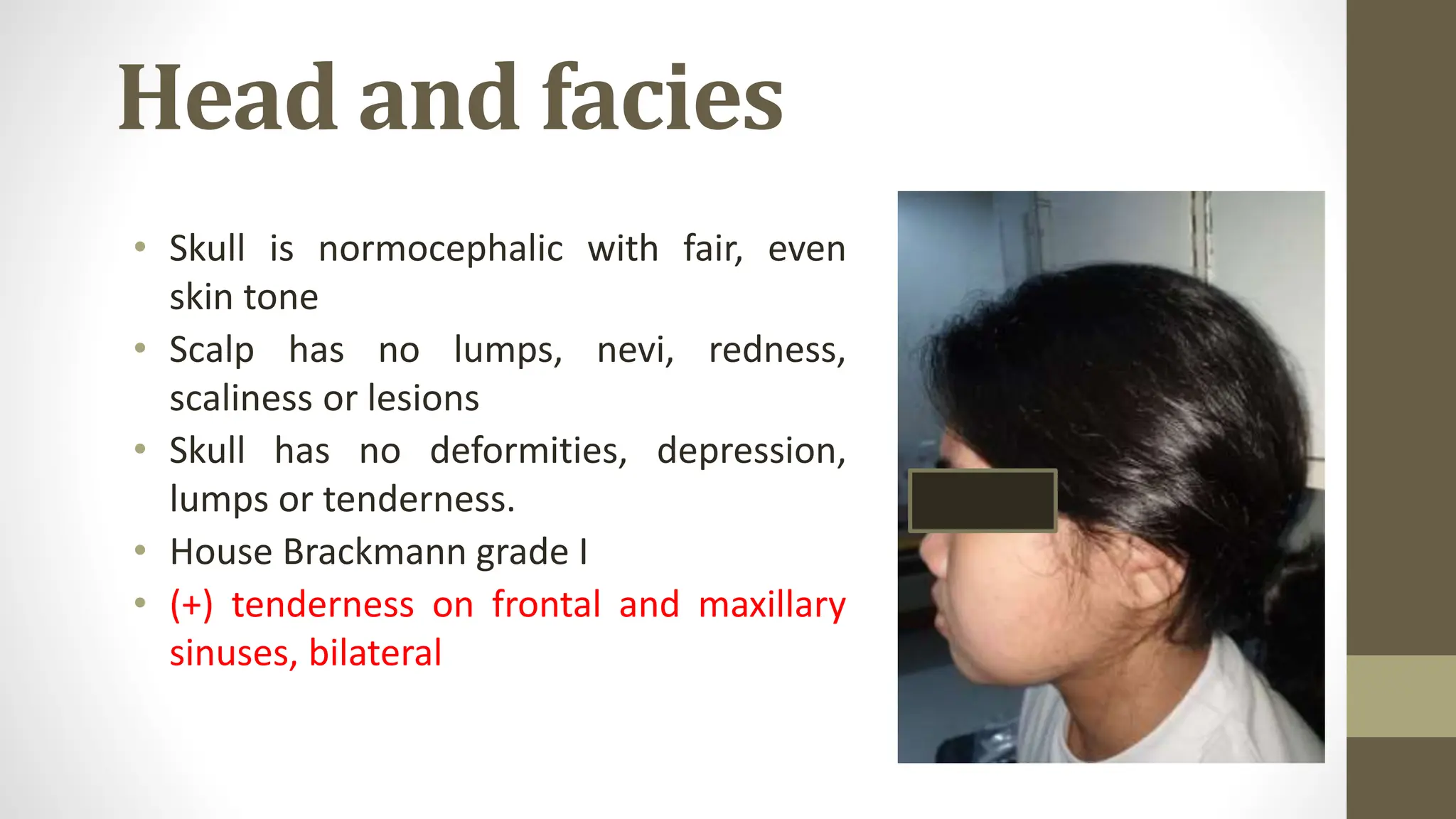 Chronic Rhinosinusitis with Nasal Polyposis grade III right | PPTX