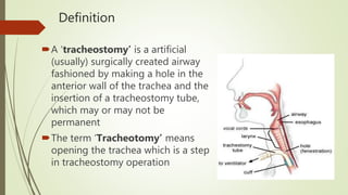 TRACHEOSTOMY | PPTX | Death, Injury, or Military Conflict | Sensitive ...