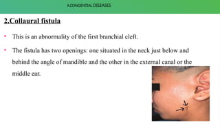 Diseases of External Ear (ENT department) | PPTX