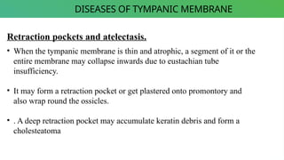 Diseases of External Ear (ENT department) | PPTX