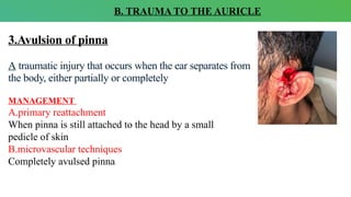 Diseases of External Ear (ENT department) | PPTX