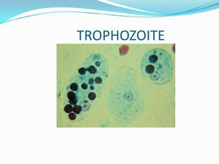 ppt on Entamoeba histolytica INTESTINAL LESIONS | PPTX