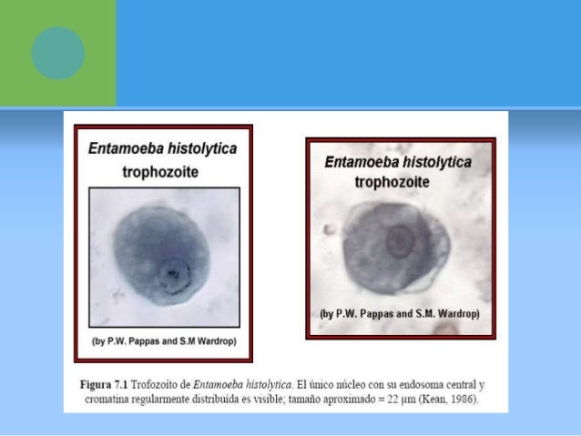 Entamoeba histolytica
