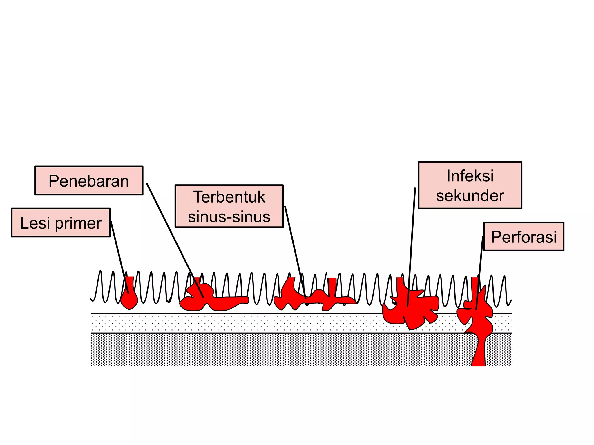 Entamoeba hystolitica & entamoeba coli | PPTX