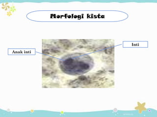 Entamoeba hystolitica & entamoeba coli | PPTX