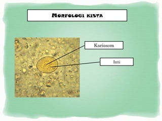 Entamoeba hystolitica & entamoeba coli | PPT