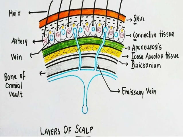 ENTANGLEMENT INJURIES .pptx