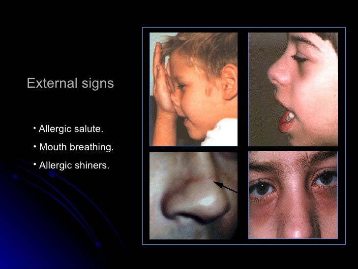 Ent By Prof. Dr.Yasser Nour.