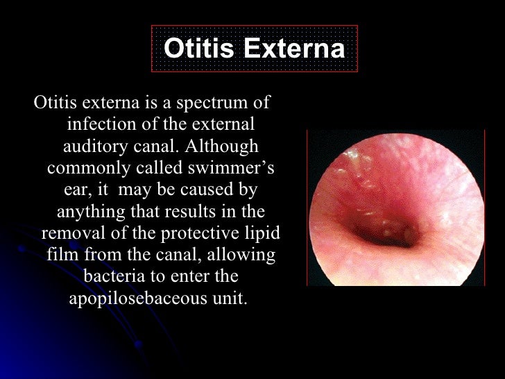 Ent By Prof. Dr.Yasser Nour.