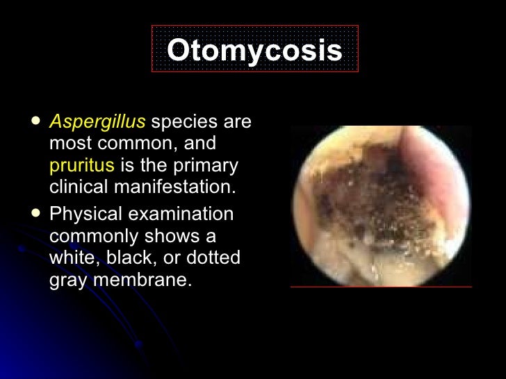 Ent By Prof. Dr.Yasser Nour.