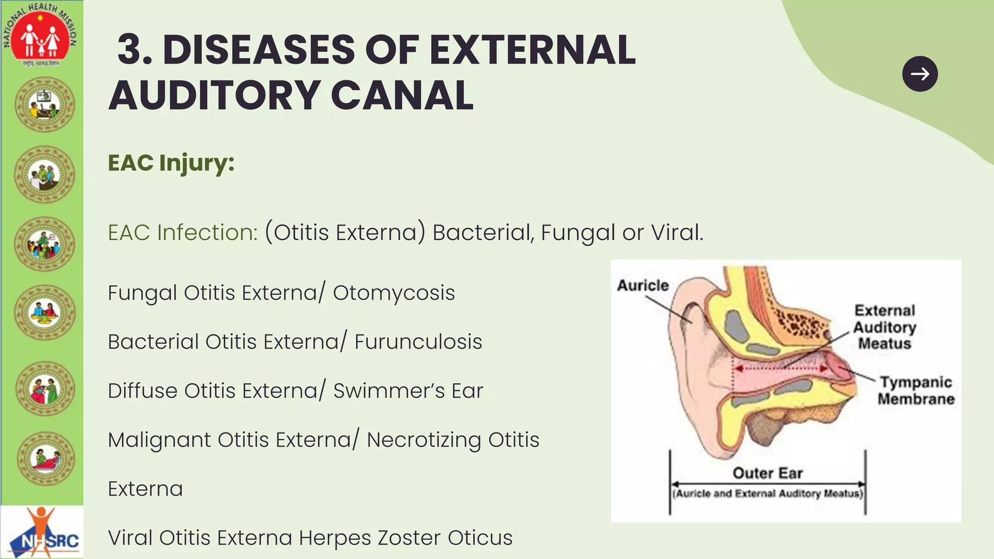 ENT Care for MO- Management of Common Ear Disorders.pdf