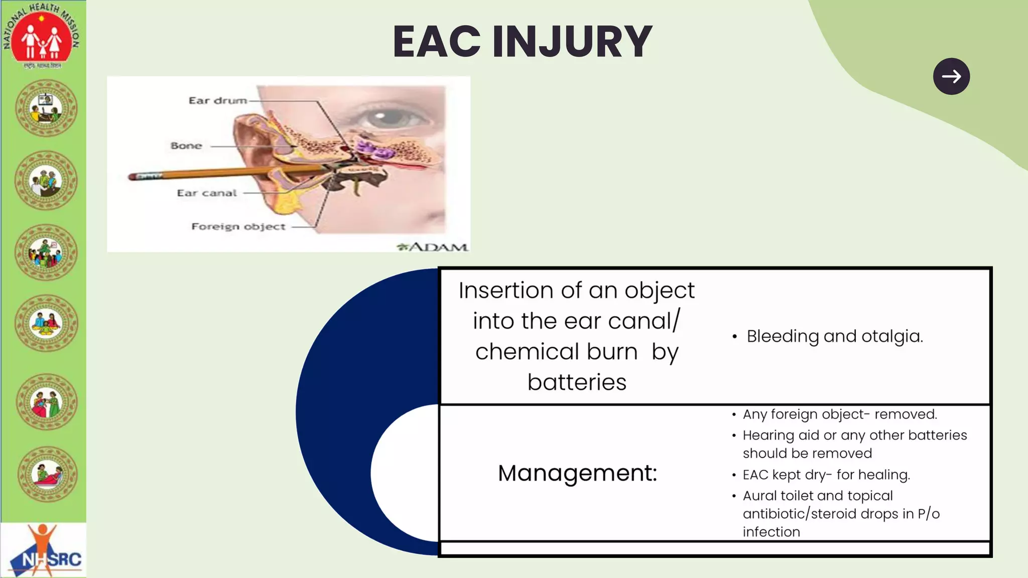 ENT Care for MO- Management of Common Ear Disorders.pdf | Ear, Nose and ...