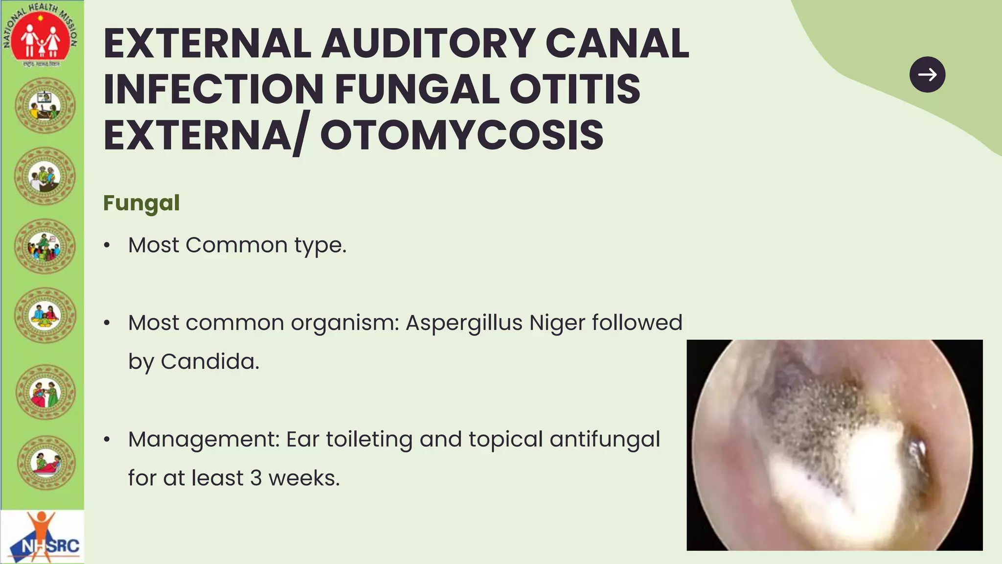 ENT Care for MO- Management of Common Ear Disorders.pdf | Ear, Nose and ...