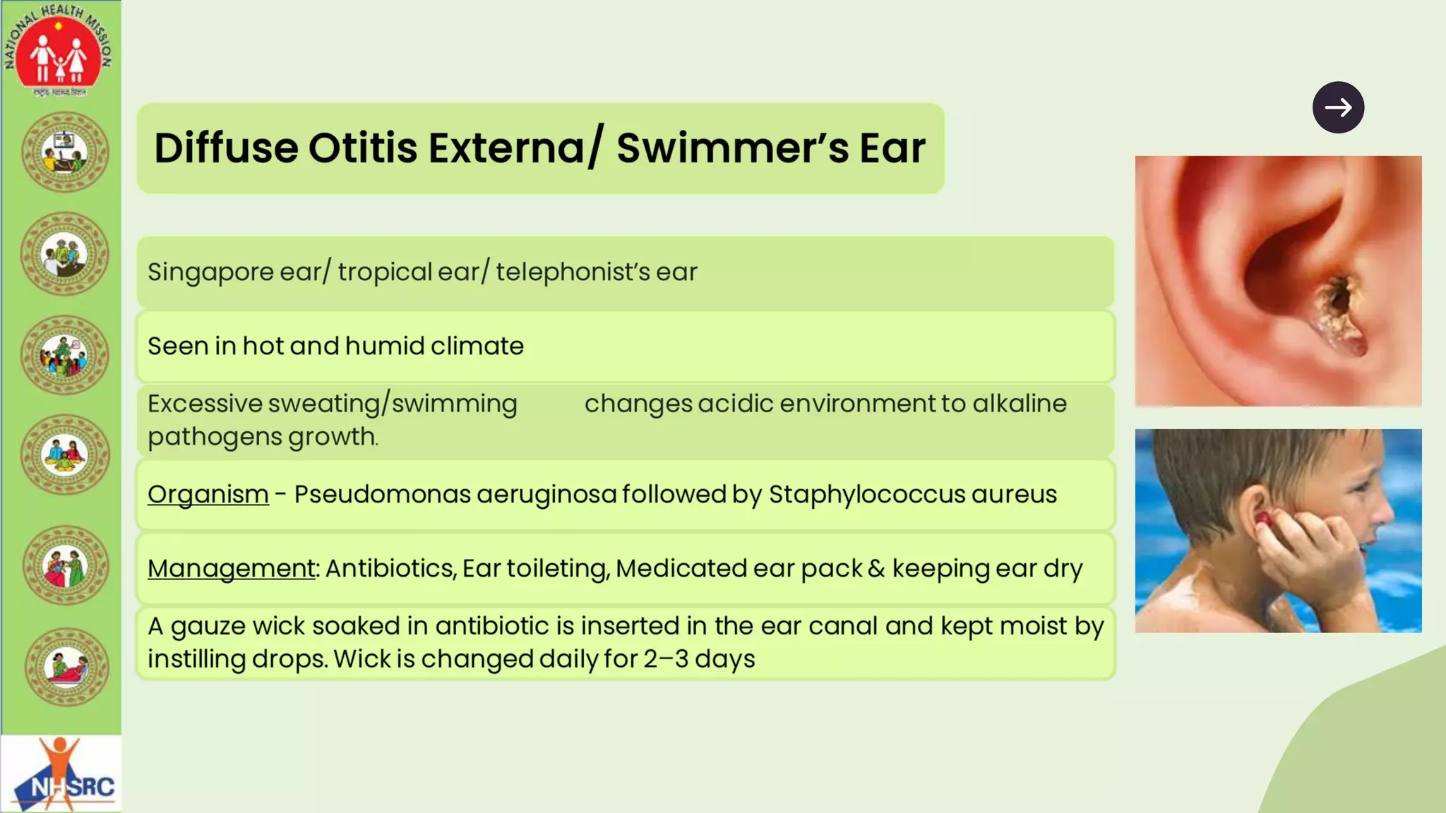 ENT Care for MO- Management of Common Ear Disorders.pdf | Ear, Nose and ...
