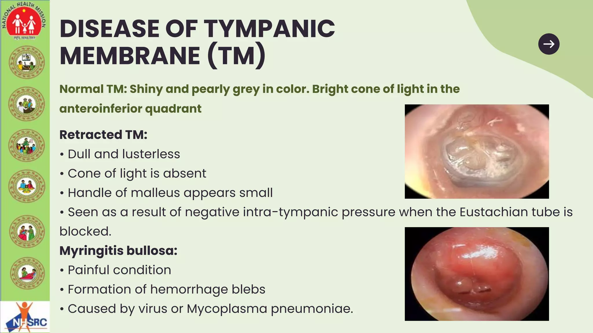 ENT Care for MO- Management of Common Ear Disorders.pdf