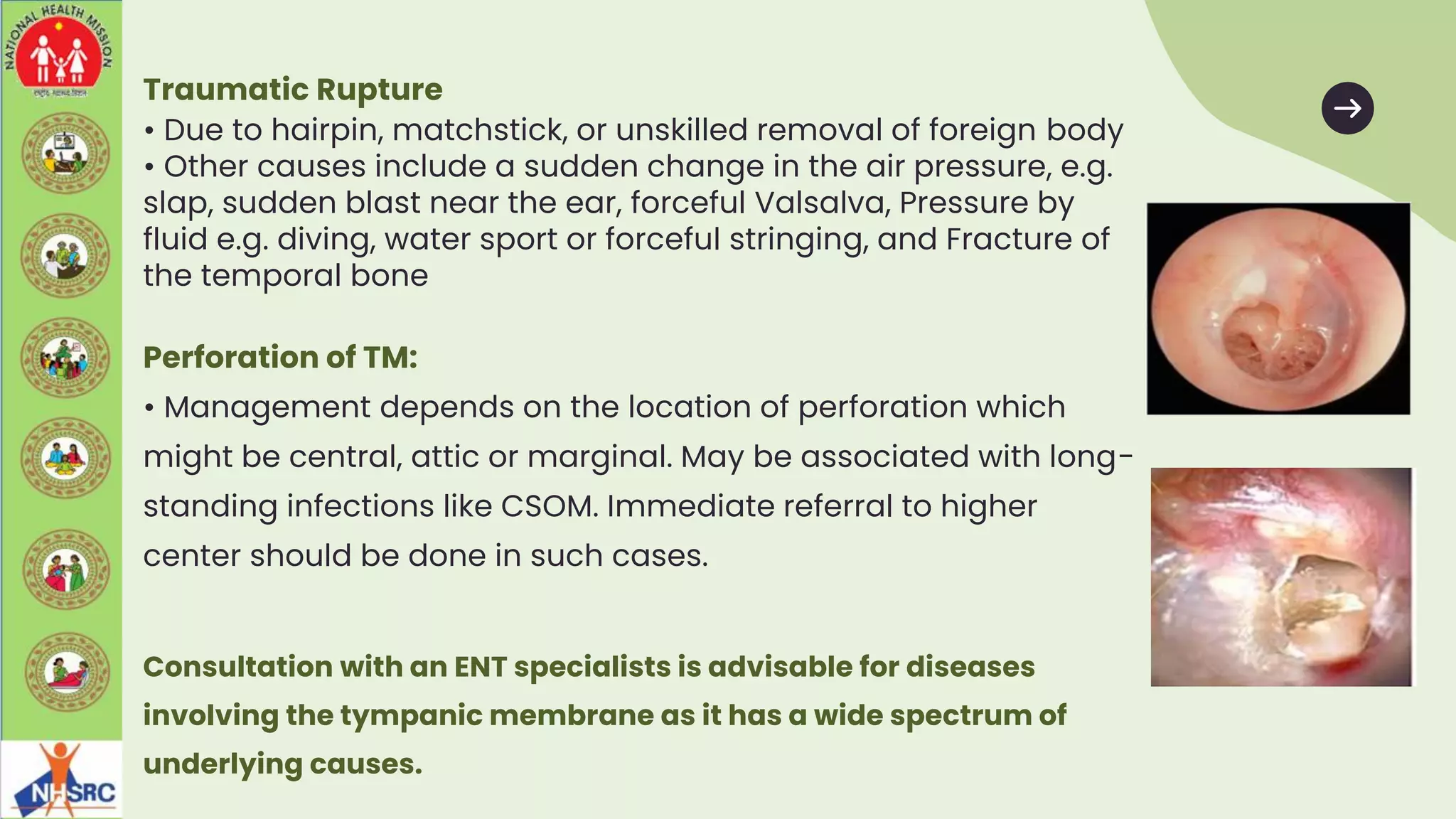 ENT Care for MO- Management of Common Ear Disorders.pdf