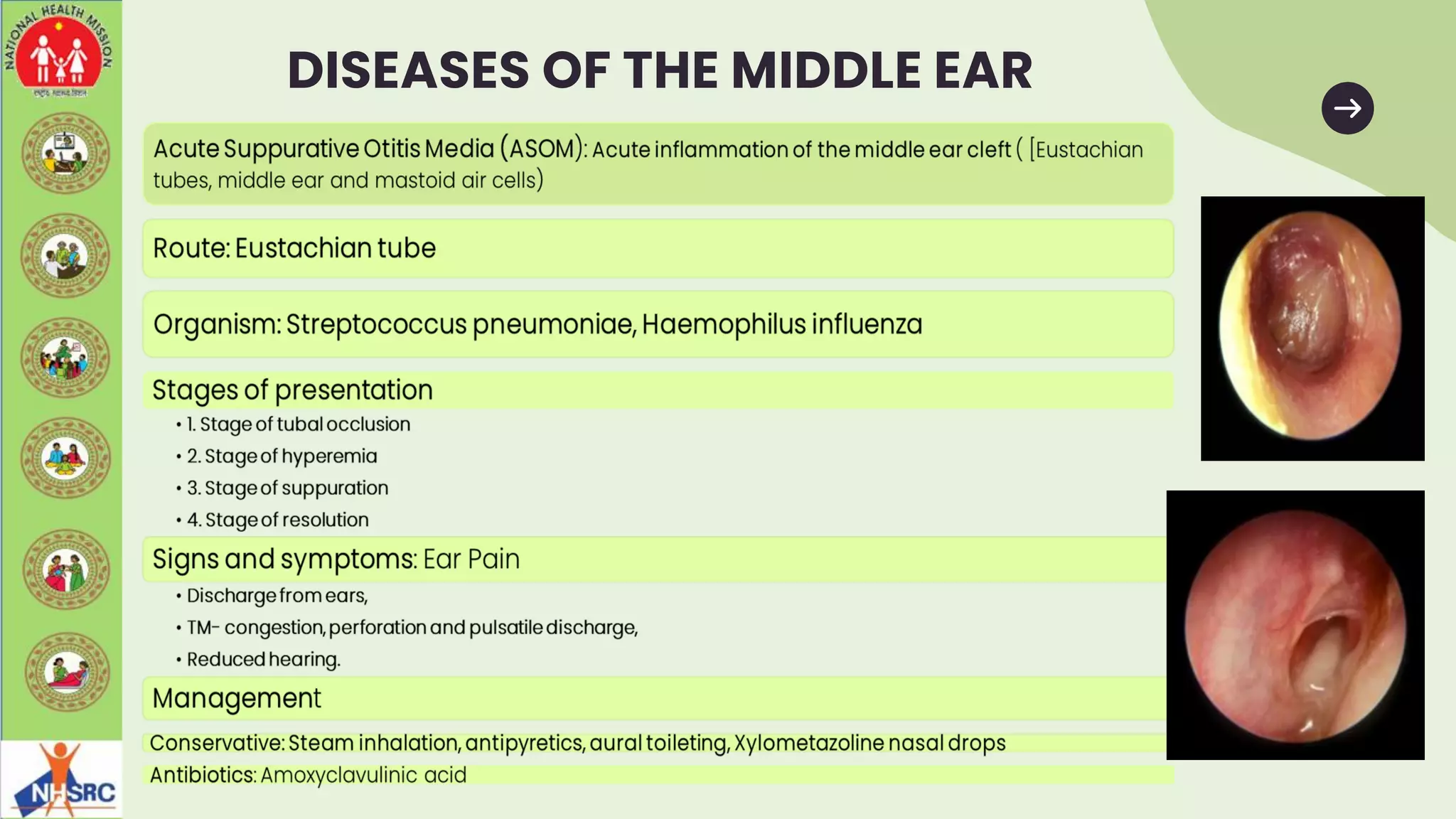 ENT Care for MO- Management of Common Ear Disorders.pdf