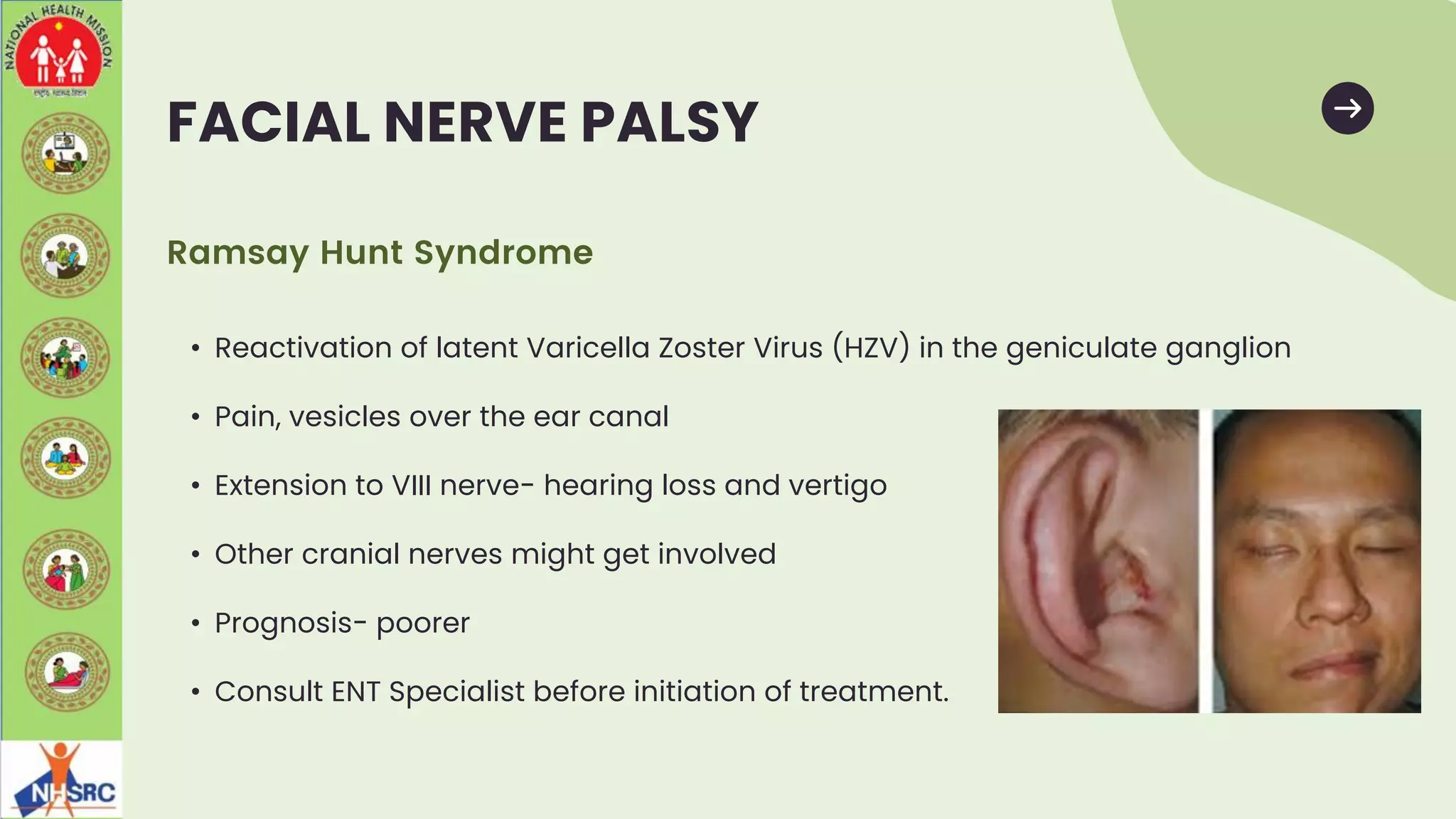 ENT Care for MO- Management of Common Ear Disorders.pdf