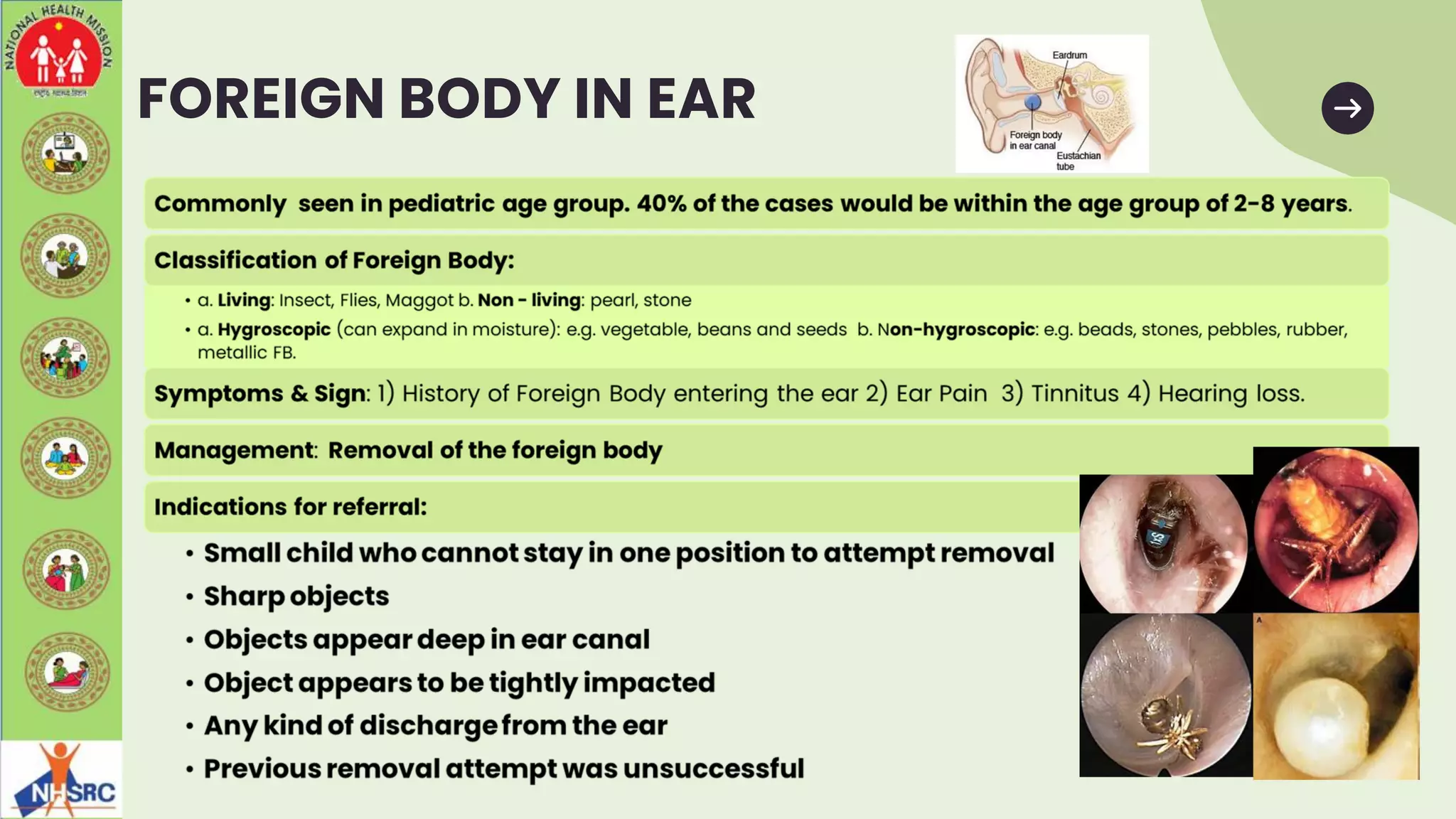 ENT Care for MO- Management of Common Ear Disorders.pdf