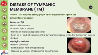 ENT Care for MO- Management of Common Ear Disorders.pdf